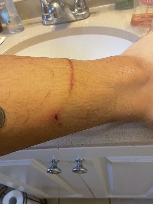 Dog Bite or Scratch?| Animal Behavior Expert Opinion | Dog Expert