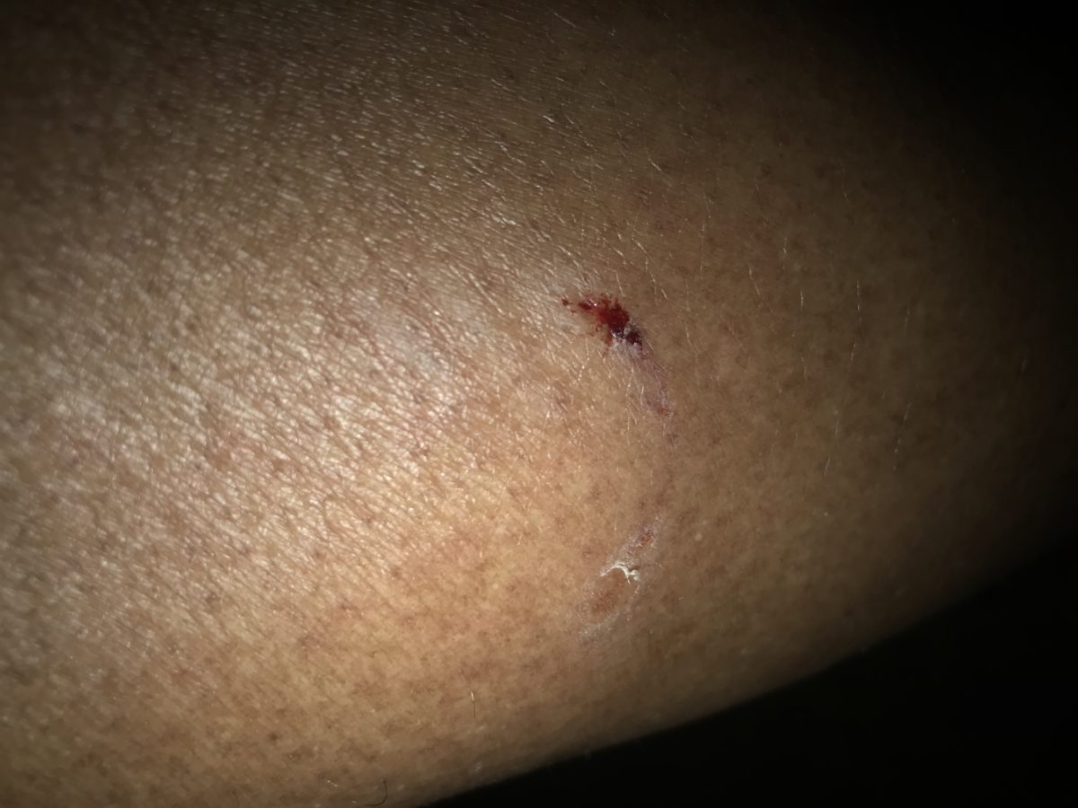 Dog Bite or Scratch?| Animal Behavior Expert Opinion | Dog Expert